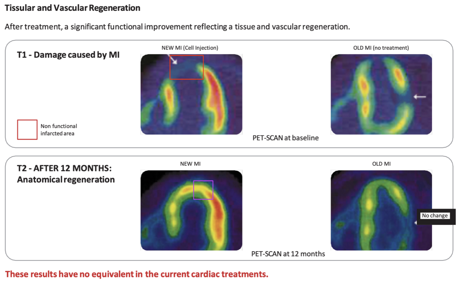 CellProthera | Post-AMI